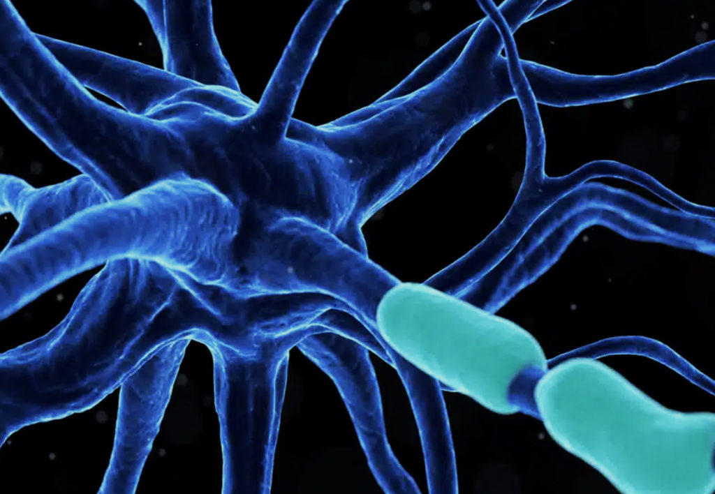 AC Immune erhält FDA Fast Track Designation für Alzheimer-Impfstoff ...